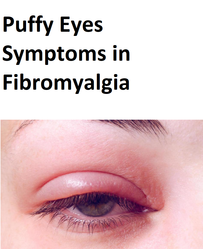 Puffy Eyes Symptoms in Fibromyalgia - STAY AWARE WITH US