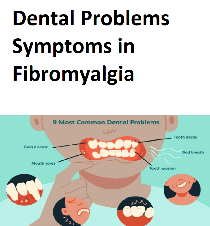 Dental Problems Symptoms in Fibromyalgia - STAY AWARE WITH US