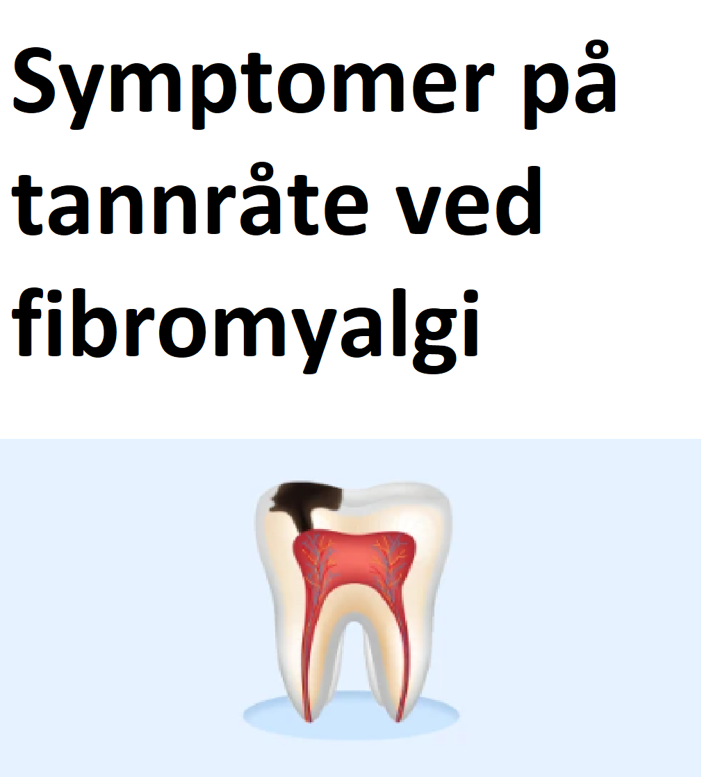 Symptomer på tannråte ved fibromyalgi - STAY AWARE WITH US